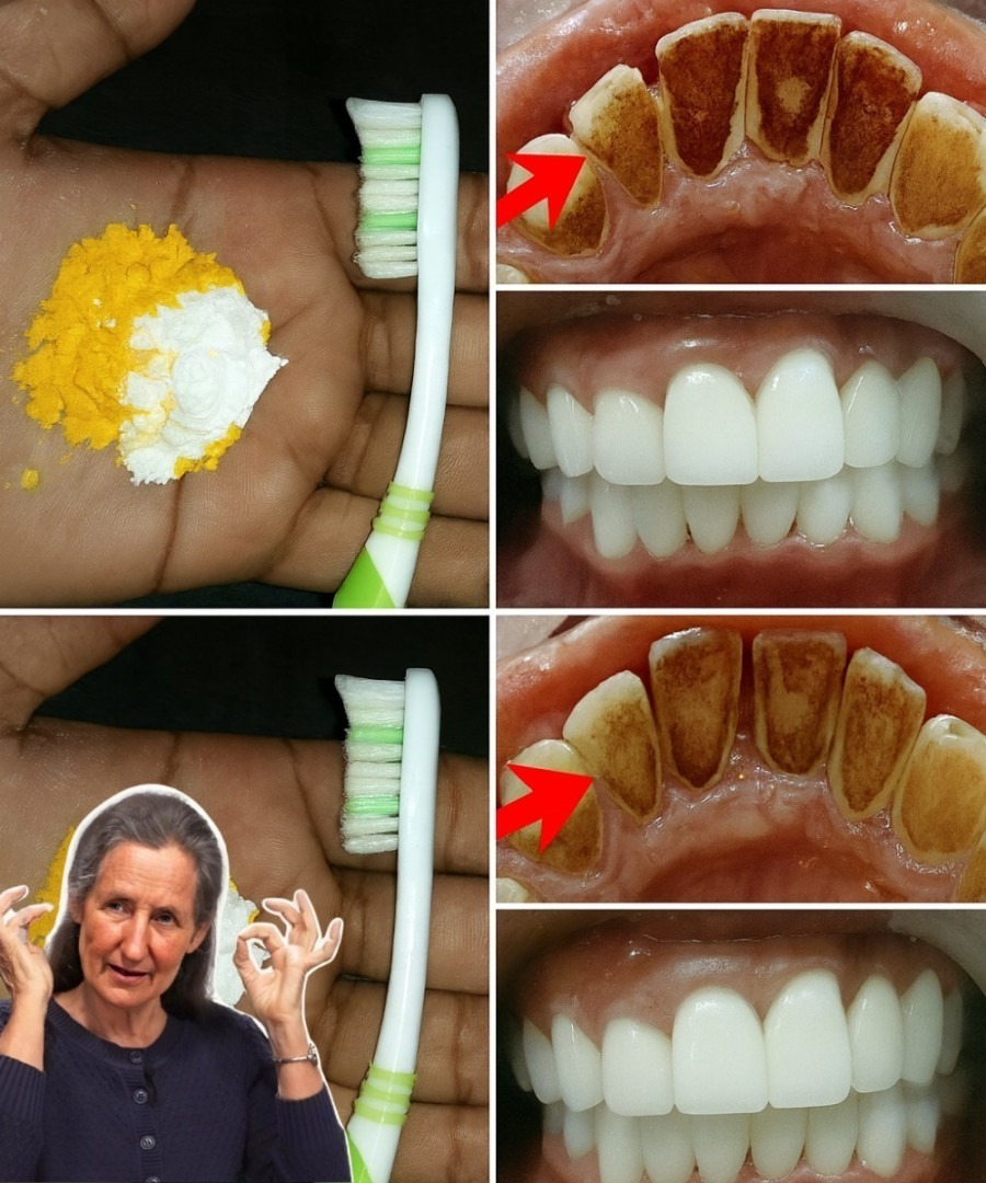 Home Teeth Whitening Get Whiter Teeth in Just 2 Minutes – kyop.fun